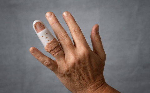 Trigger Finger - Midlands Orthopaedics & Neurosurgery